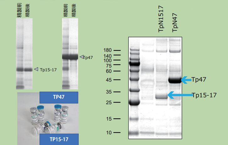 Specific Antigen of Treponema pallidum, Cause Agent of Syphilis ...